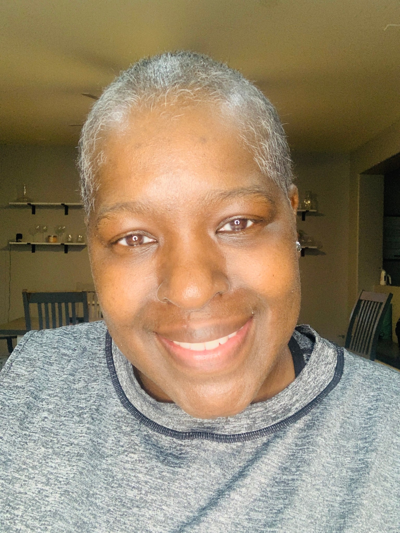03-Triple Negative Breast Cancer – Metaplastic – Update & Hair Loss ...